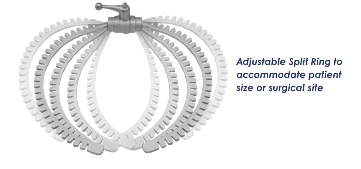 ENTrac™ Retraction Systems – Mediflex Surgical Products