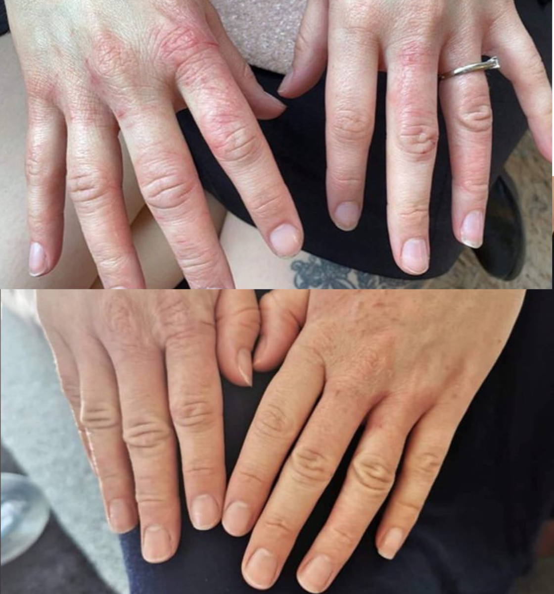 Skin Transformations