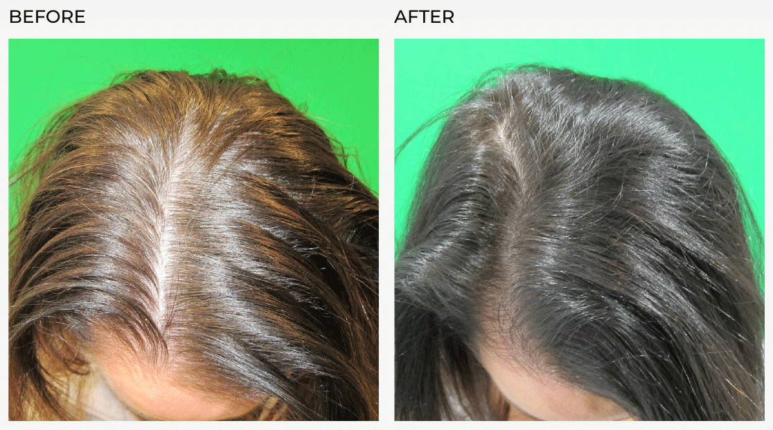 DeeplyRooted- Hair Growth Supplement – Hush & Hush