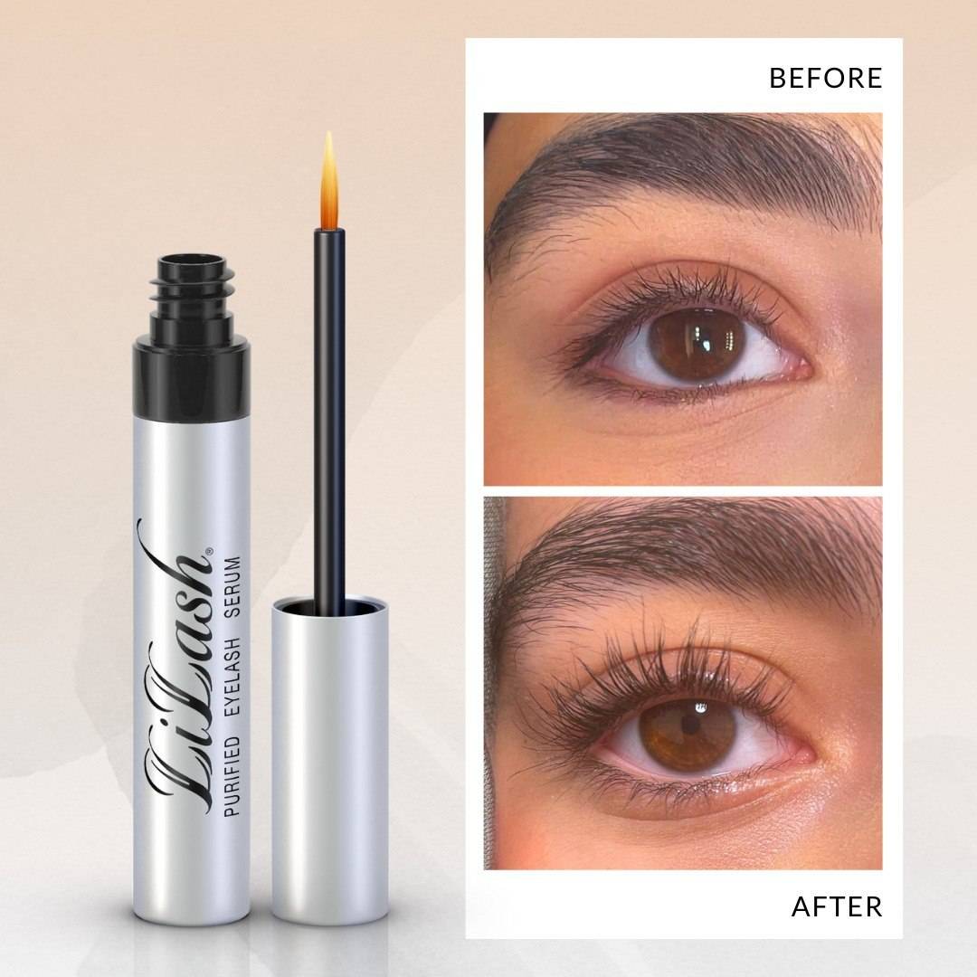 Dreaming of Perfect Lashes and Brows? Discover Growth Serums! - Vivo ...