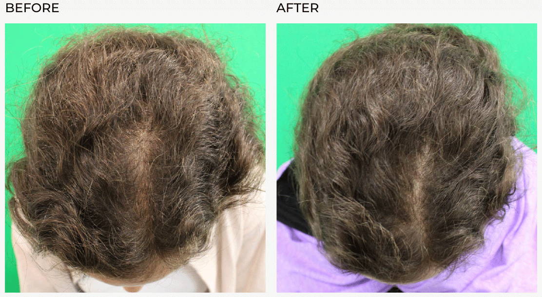 DeeplyRooted- Hair Growth Supplement – Hush & Hush