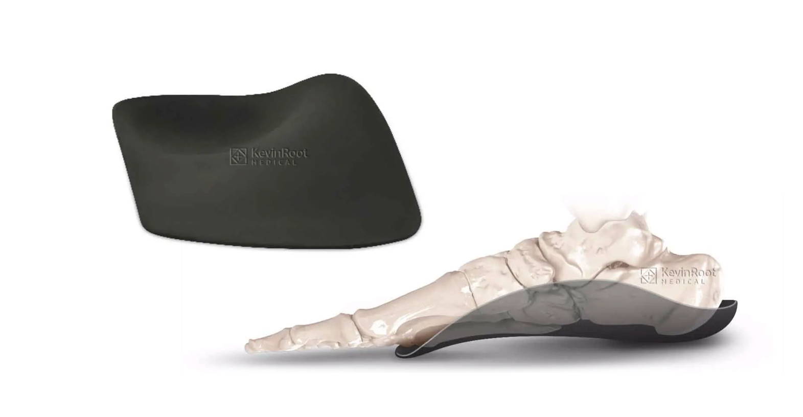 Medial Flange – KevinRoot Medical