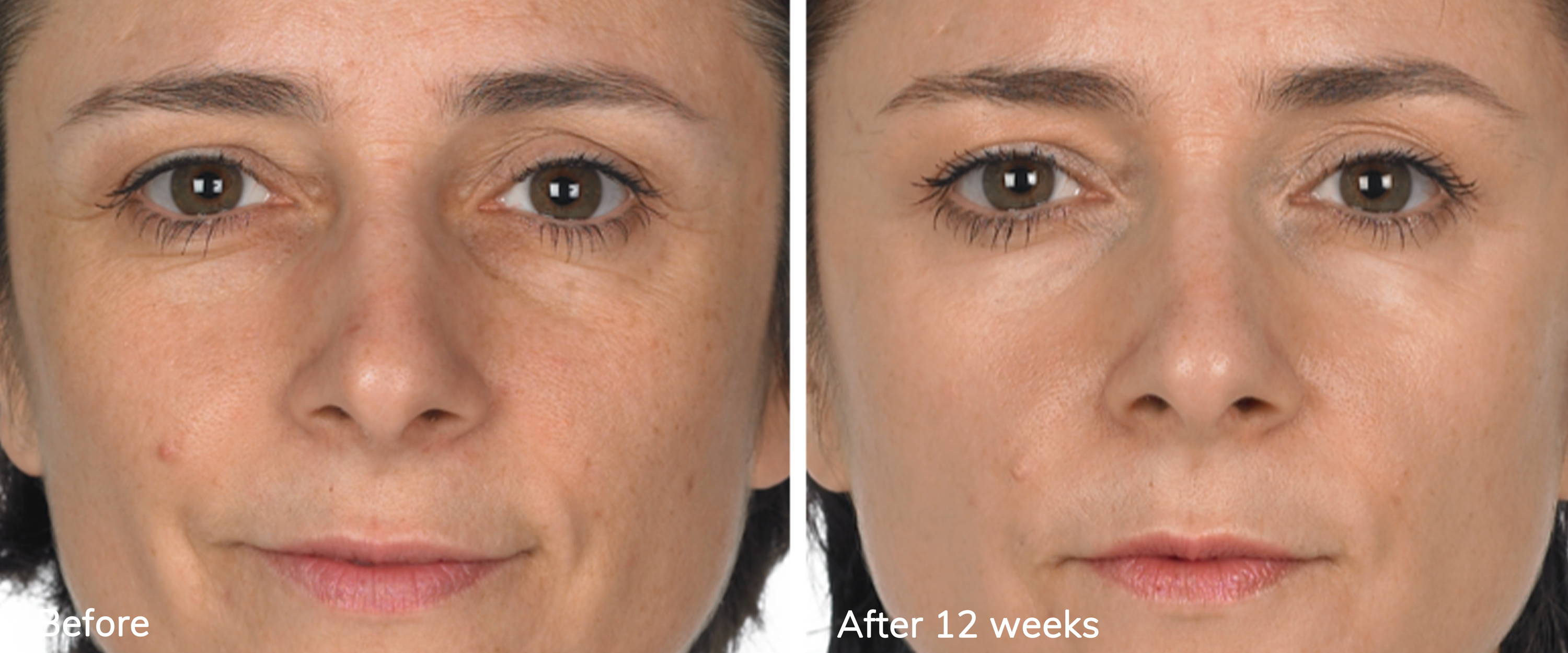 SHOP MD COMPLETE PROFESSIONAL ANTI-AGING SKINCARE PRODUCTS – MD ...